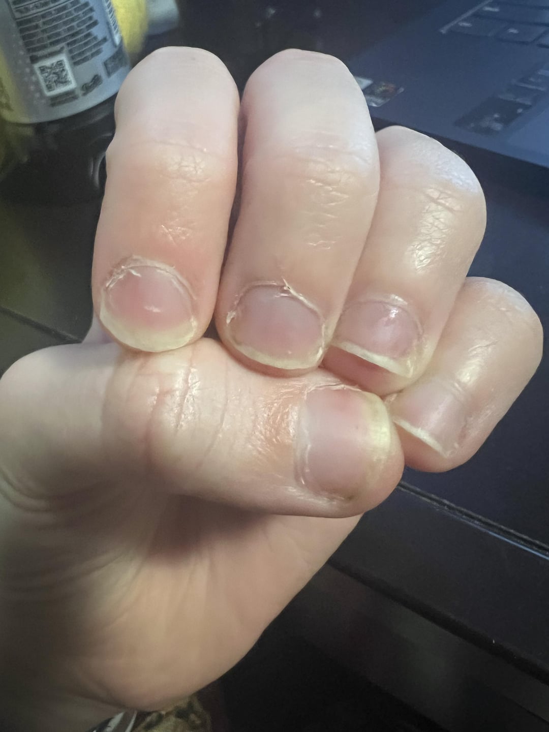how to make nails look more clean for nail polish? - COSMESTIC.COM ...