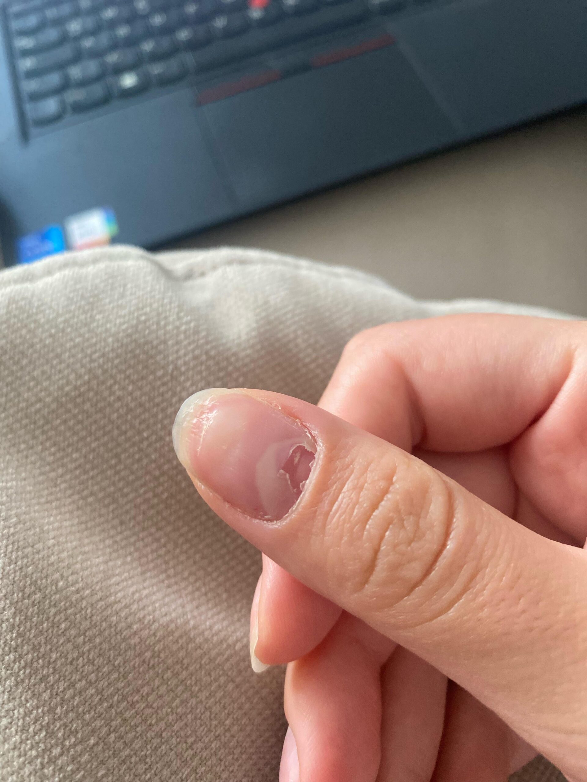 Help, I broke my nail – COSMESTIC.COM ~ Beauty, Makup, and Cosmetics