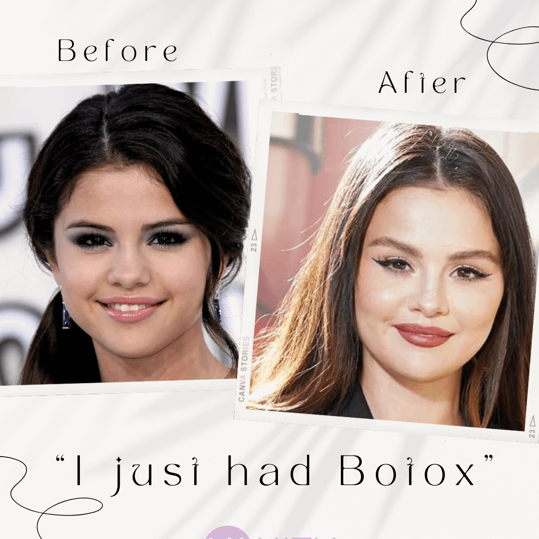 Selena Gomez Reacted to Cosmetic Surgery Rumors and she ended them with ...