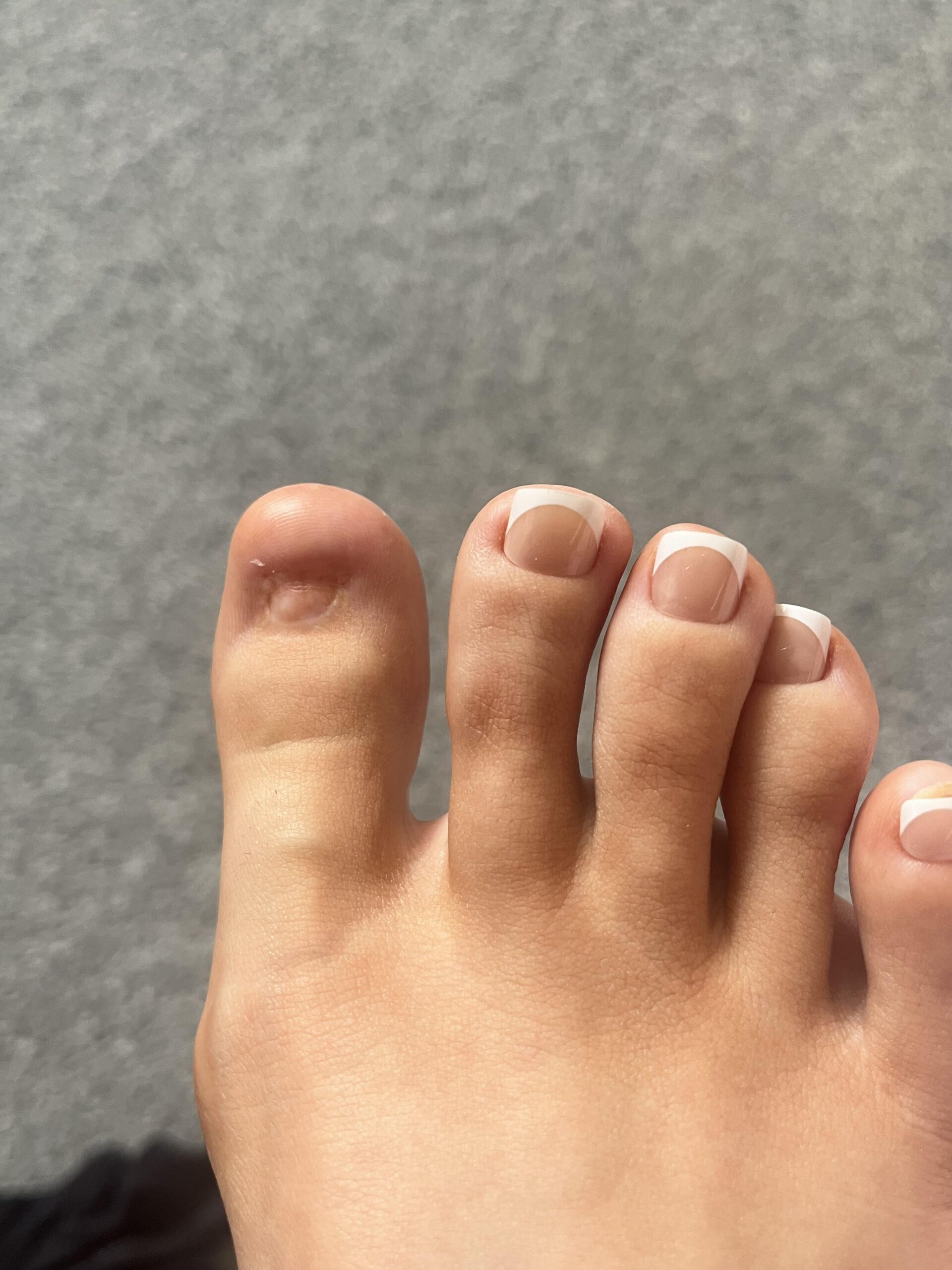 No big toe nails – COSMESTIC.COM ~ Beauty, Makup, and Cosmetics