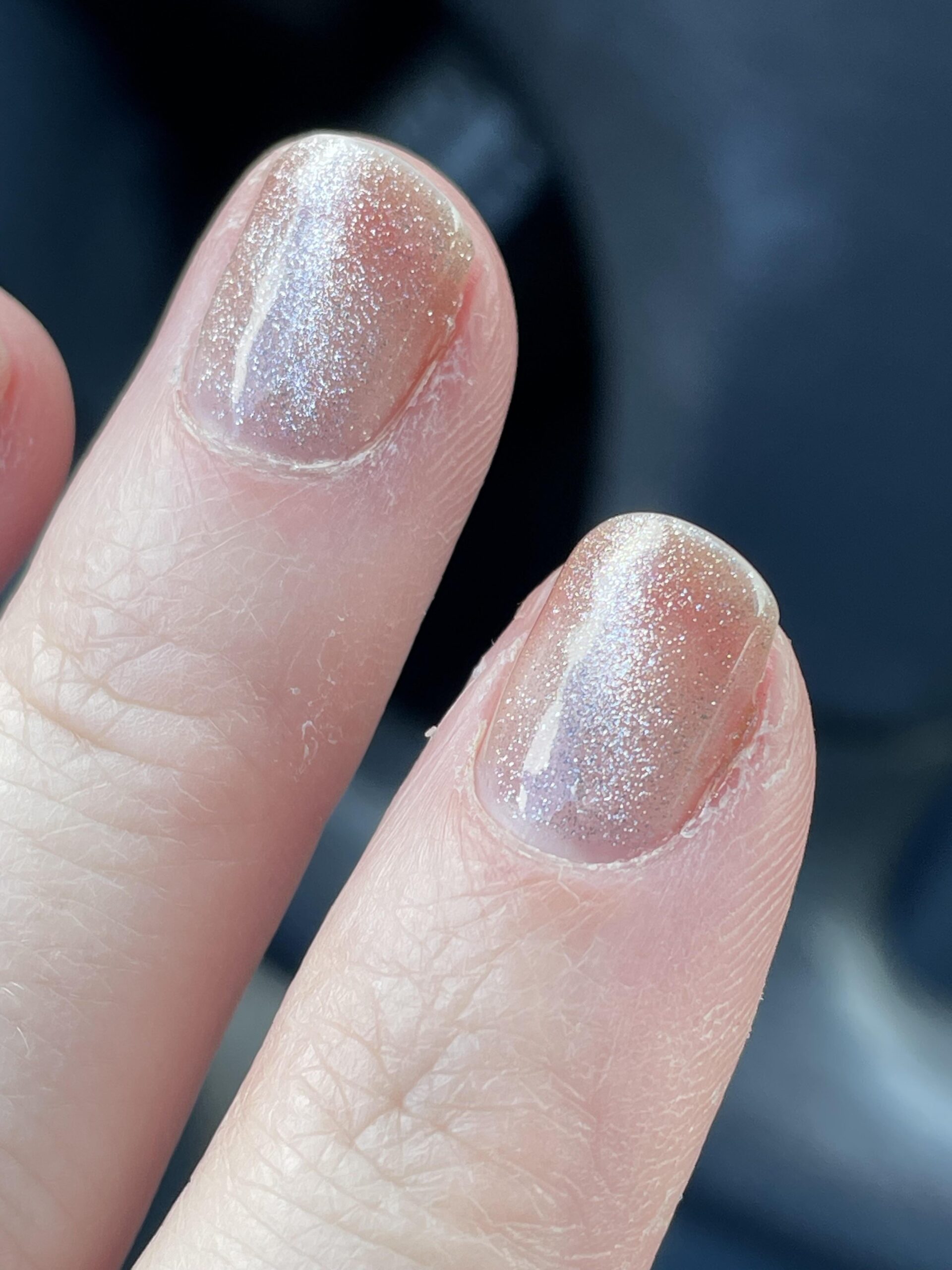 How can I fix the area around my cuticles? – COSMESTIC.COM ~ Beauty ...