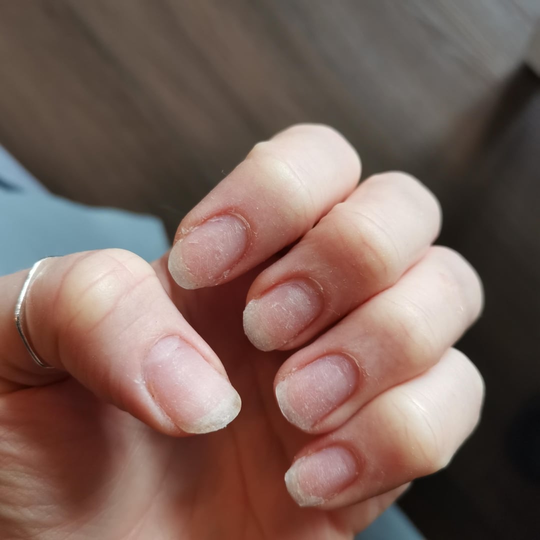 Newbie Before & After - COSMESTIC.COM ~ Beauty, Makup, and Cosmetics