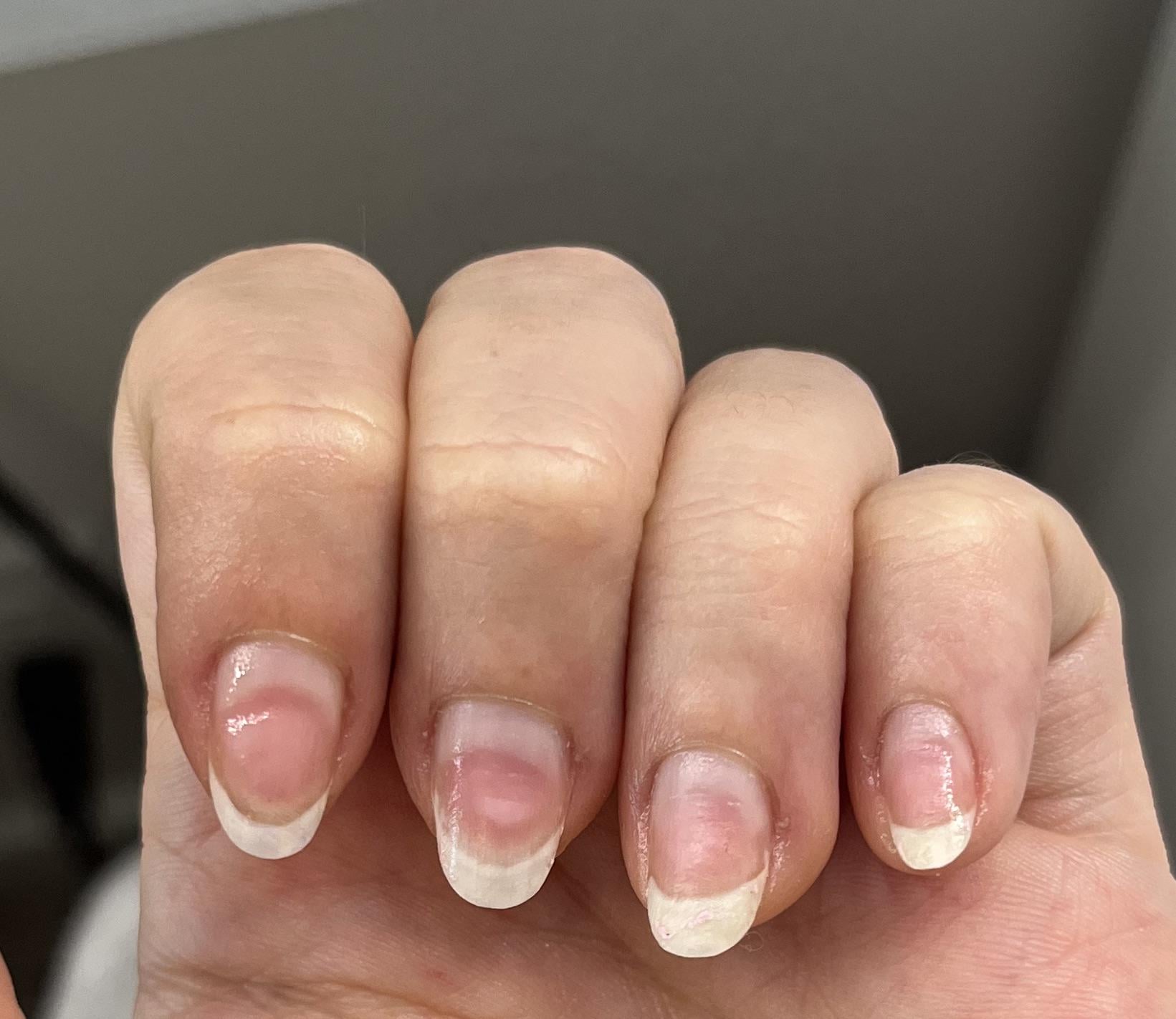 damaged nails? - COSMESTIC.COM ~ Beauty, Makup, and Cosmetics