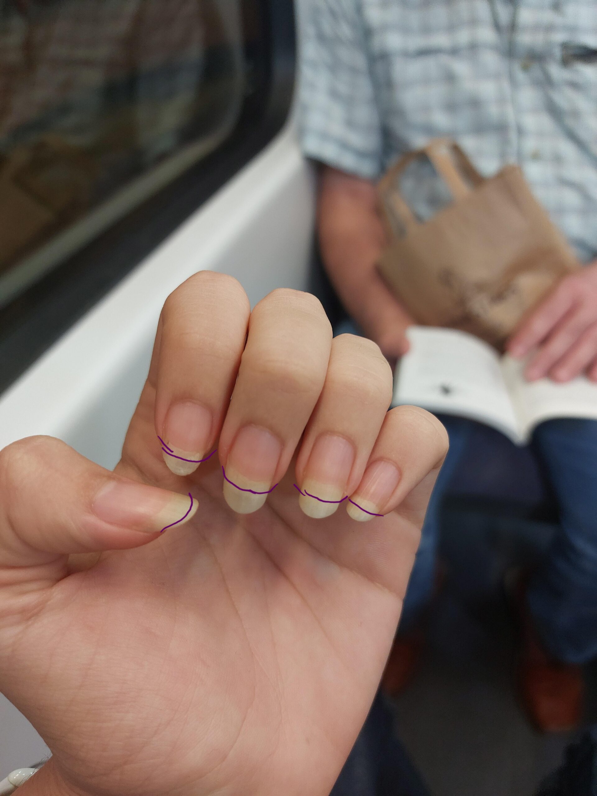 How can I make the part under the nails longer – COSMESTIC.COM ~ Beauty ...